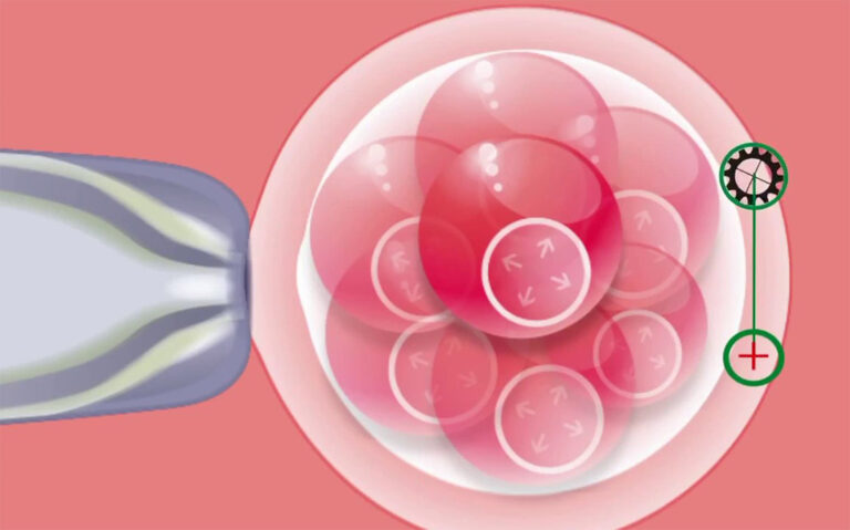 Laser Assisted Hatching System - Genesis IVF Advanced Fertility Clinic
