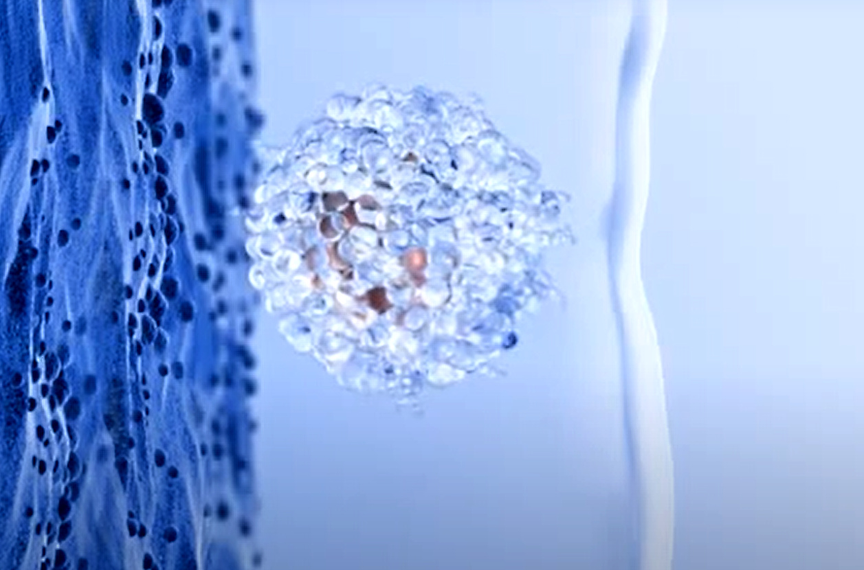 Embryo Glue - Genesis IVF Advanced Fertility Clinic